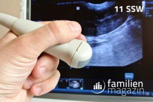 11. Schwangerschaftswoche (SSW) - Die erste Ultraschalluntersuchung